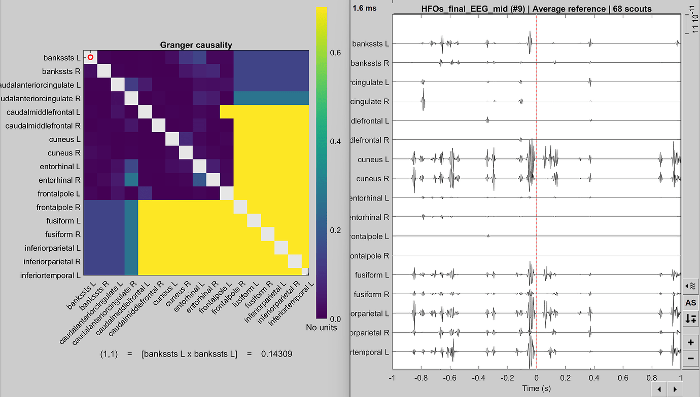 Granger Causality Matrix Error Bugs Brainstorm