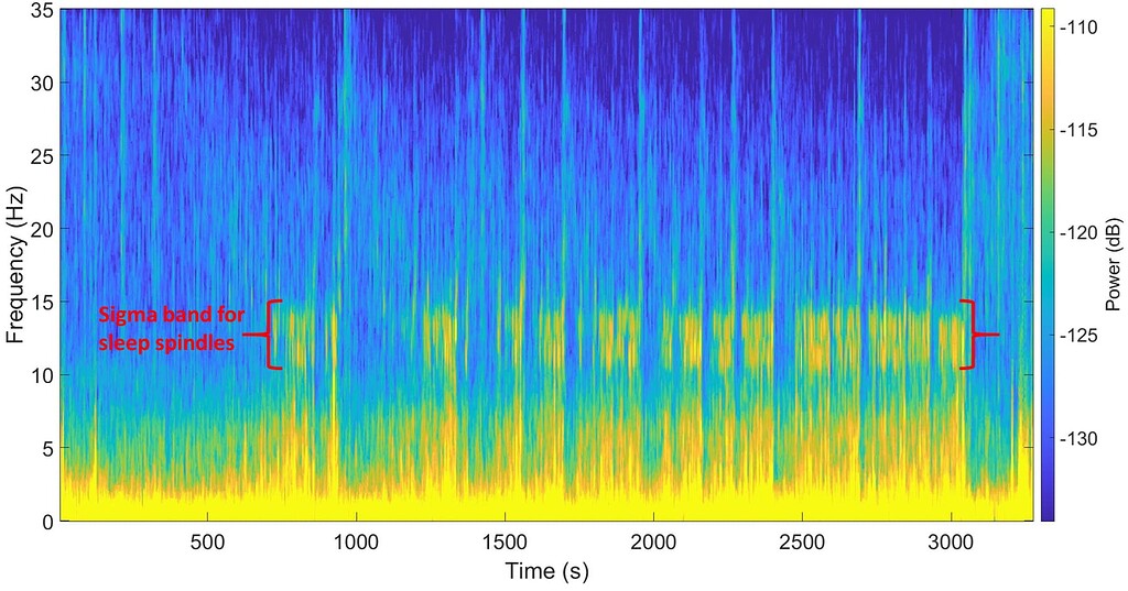 Multitaper spectrogram - Prerau et al. (2017) - Discussions - Brainstorm