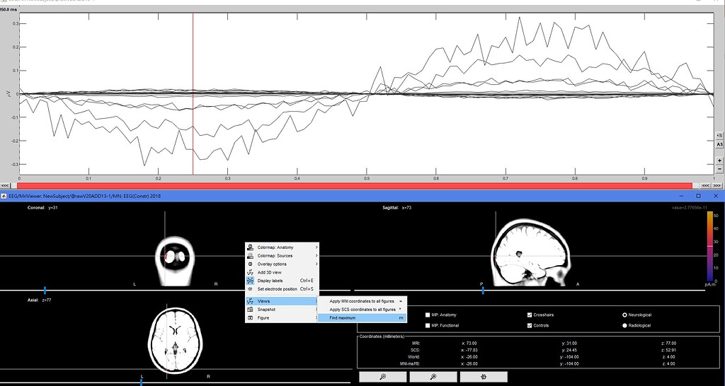 How to use the code on brainstorm in the matlab - Discussions - Brainstorm