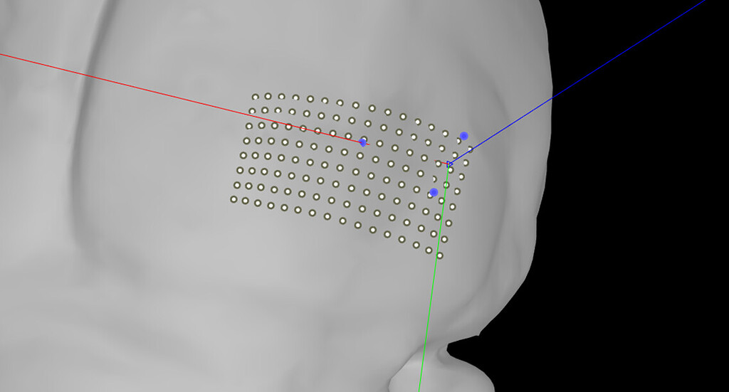 Electrode projection on cortex surface - Discussions - Brainstorm