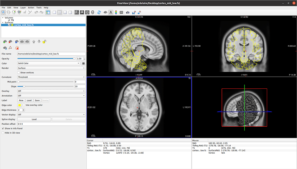 Exporting surface, not aligned with MRI in FreeView - Bugs - Brainstorm