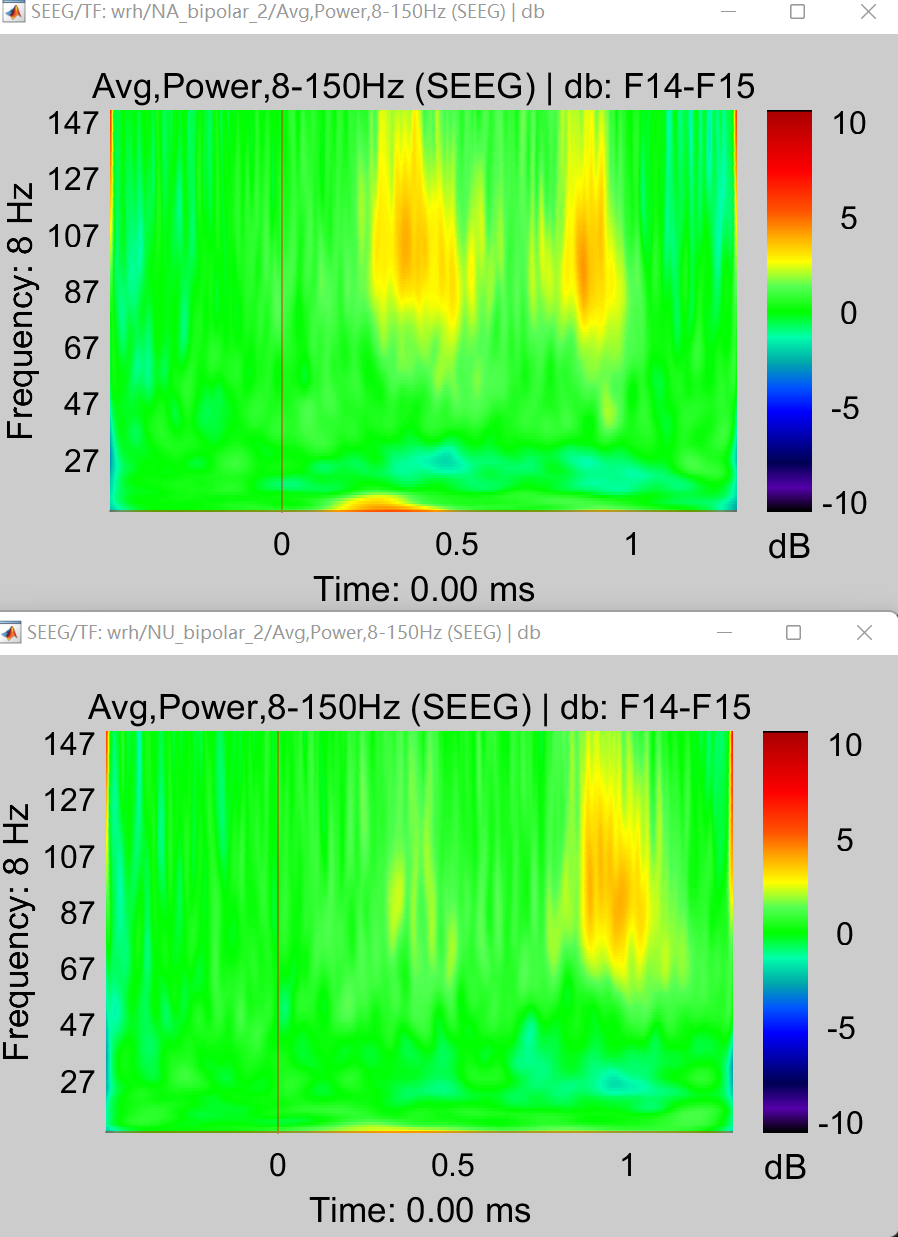 Do statistic tests on time-frequency maps between 2 conditions with or ...