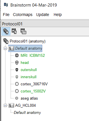 Compute sources - stuck on "Getting bad channels" - Bugs - Brainstorm